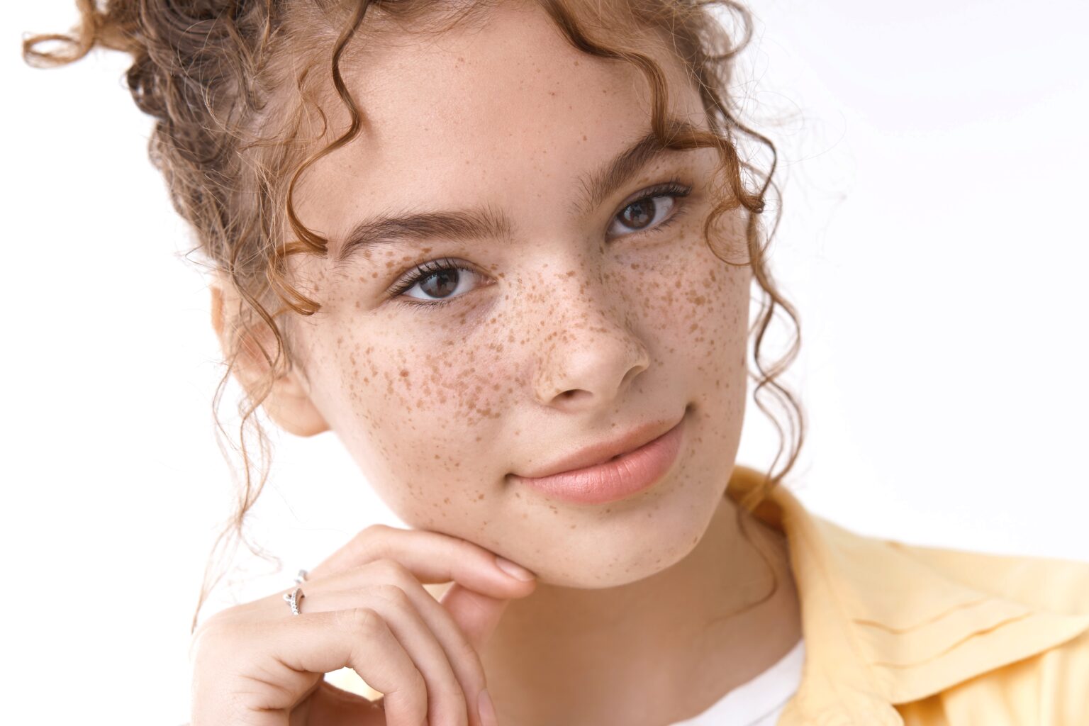 Pigmentation Treatment | A Klinik Penang