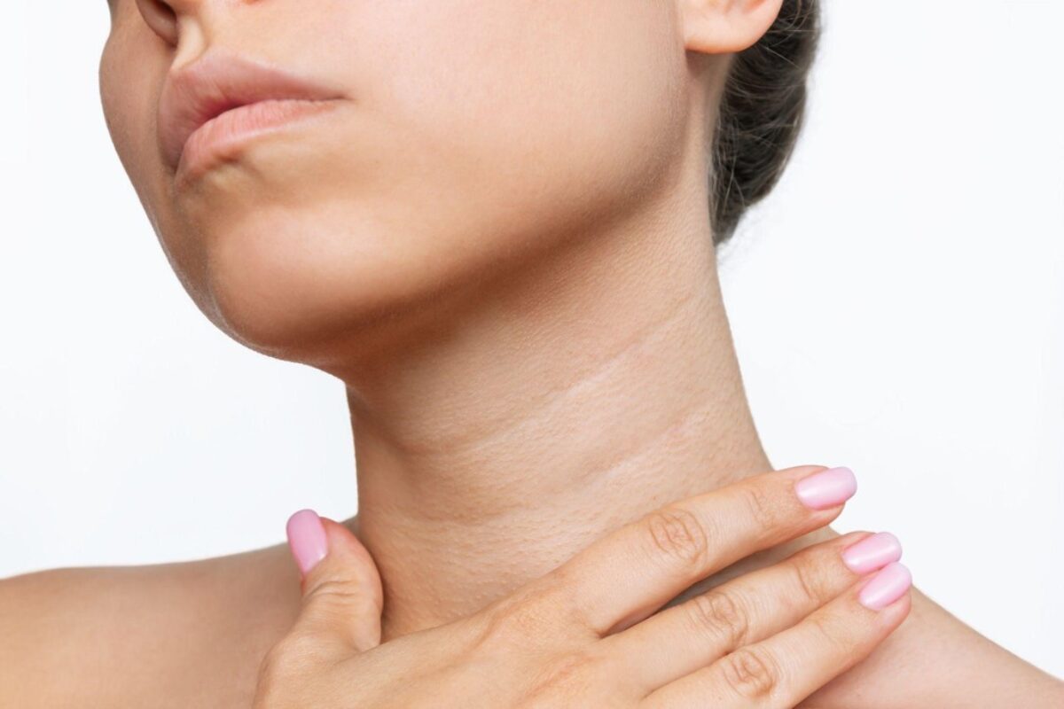 Neck Lines | A Klinik Signature