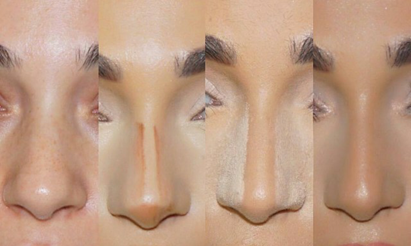 Flared Nostrils: How to Make Them Look Less Noticeable
