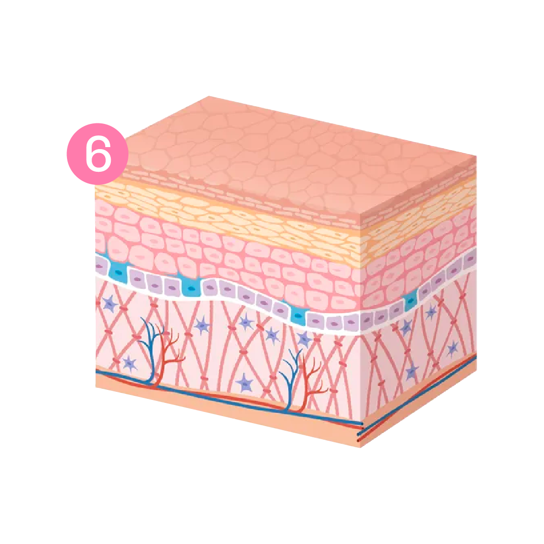 Ellanse Dermal Fillers in KL & Penang | A Klinik Signature