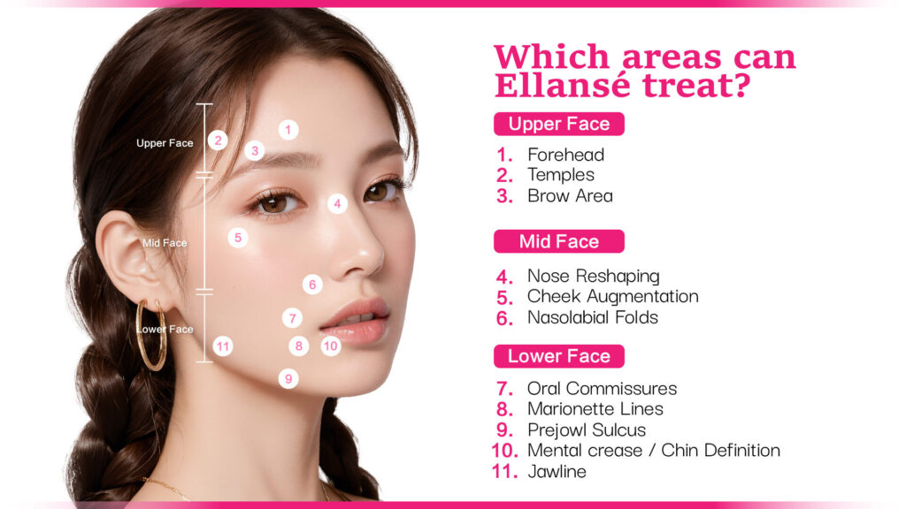 Ellanse Dermal Fillers in KL & Penang | A Klinik Signature